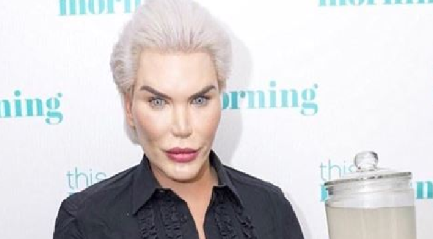 Ken humano exibe costelas retiradas do próprio corpo após plástica - Virgulistas Brasil